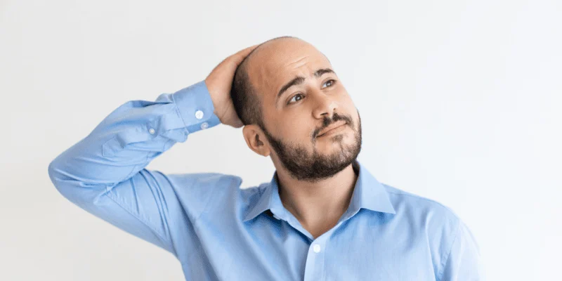 Hair Fall Causes in Men | Hair Revive Hub